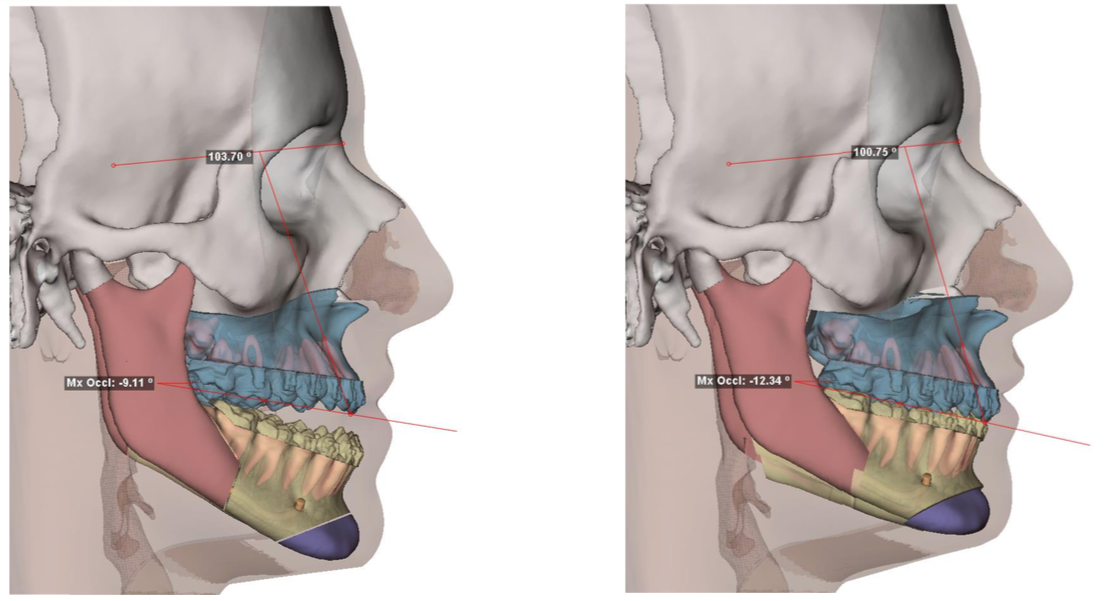 Tratamento de deformidades Dentofaciais • Scheffer & Warszawsky